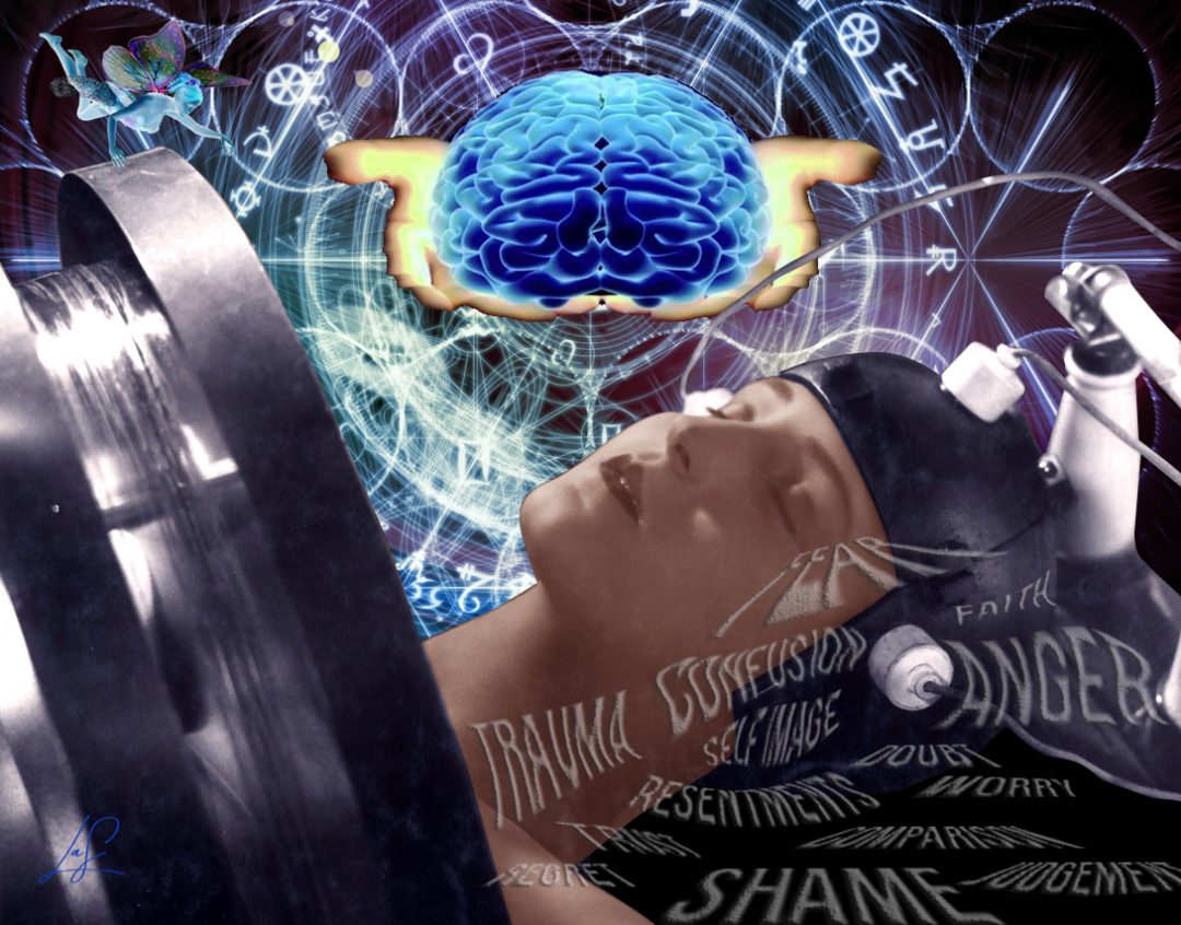 I’ll Take a Frontal Lobotomy, Please | Mindfulosity